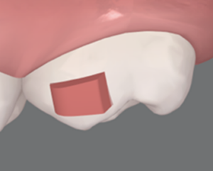 Ataches, ¿Cuál es su función y que tipos de ataches hay? - Smart ...